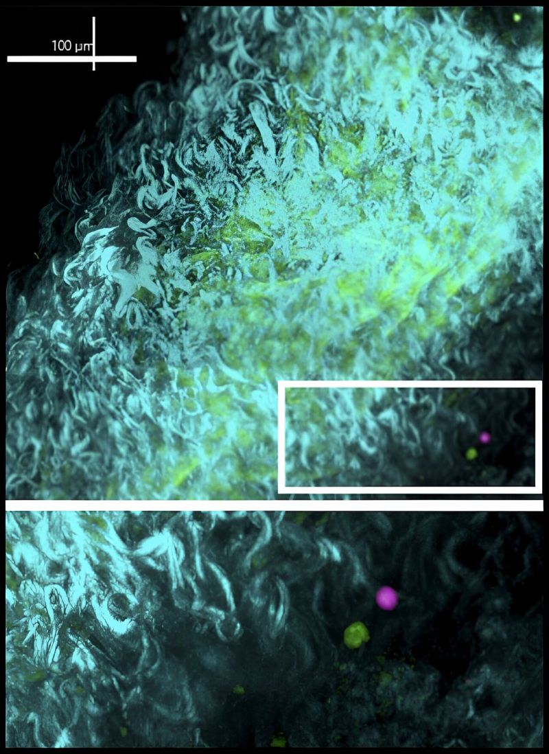 Phys.org on LinkedIn: Scientists investigate link between 'deprogrammed ... Phys.org on LinkedIn: Scientists investigate link between 'deprogrammed ...