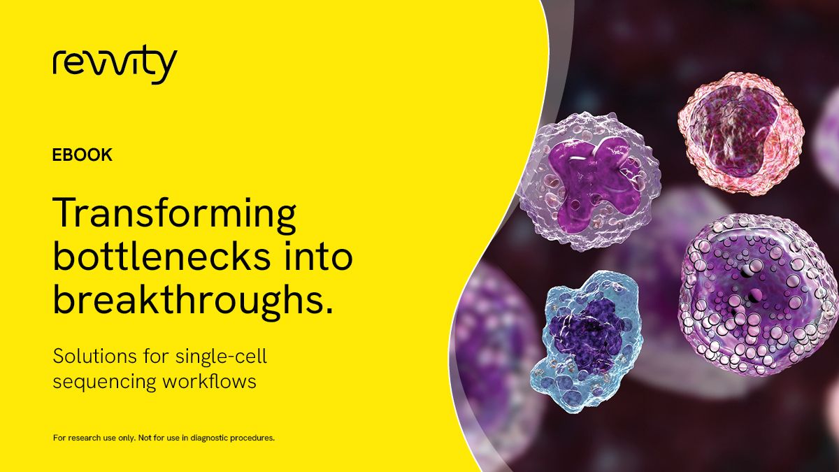 Revvity for Life Sciences on LinkedIn: Transforming bottlenecks into ... Revvity for Life Sciences on LinkedIn: Transforming bottlenecks into ...