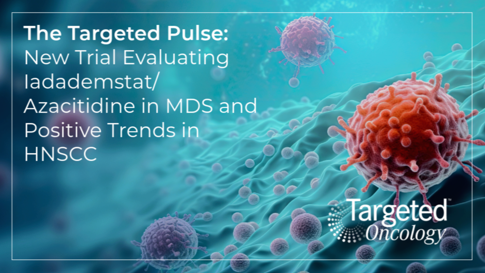 The Targeted Pulse: New Trial Evaluating Iadademstat/Azacitidine in MDS ... The Targeted Pulse: New Trial Evaluating Iadademstat/Azacitidine in MDS ...