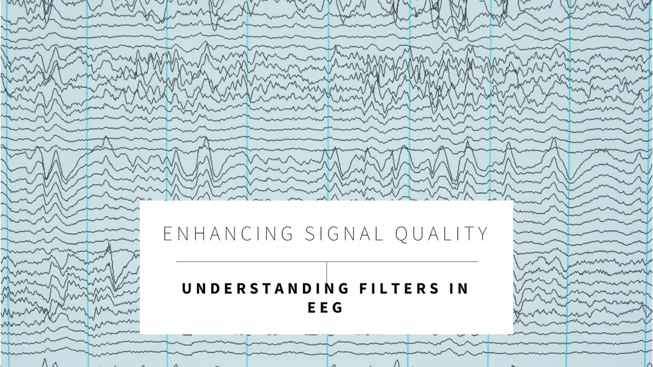 Understanding Filters in EEG: Enhancing Signal Quality for Accurate ... Understanding Filters in EEG: Enhancing Signal Quality for Accurate ...