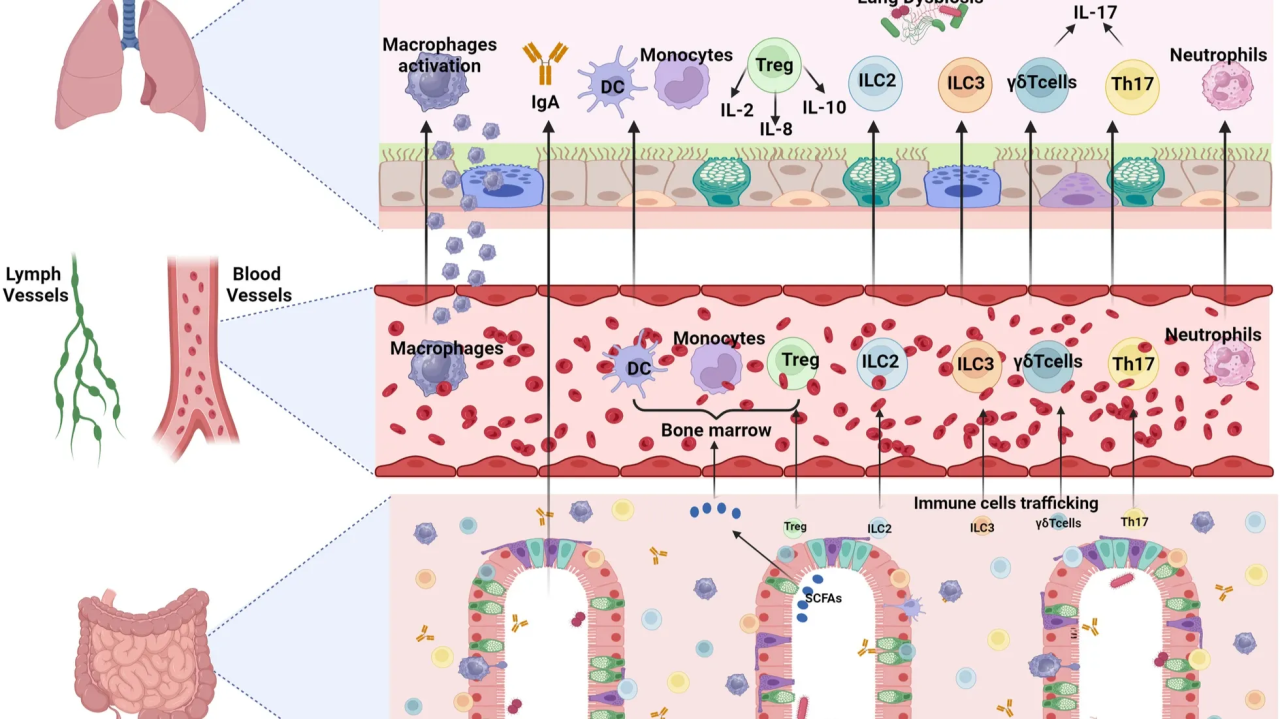 Gut-derived immune cells and the gut-lung axis in ARDS Gut-derived immune cells and the gut-lung axis in ARDS