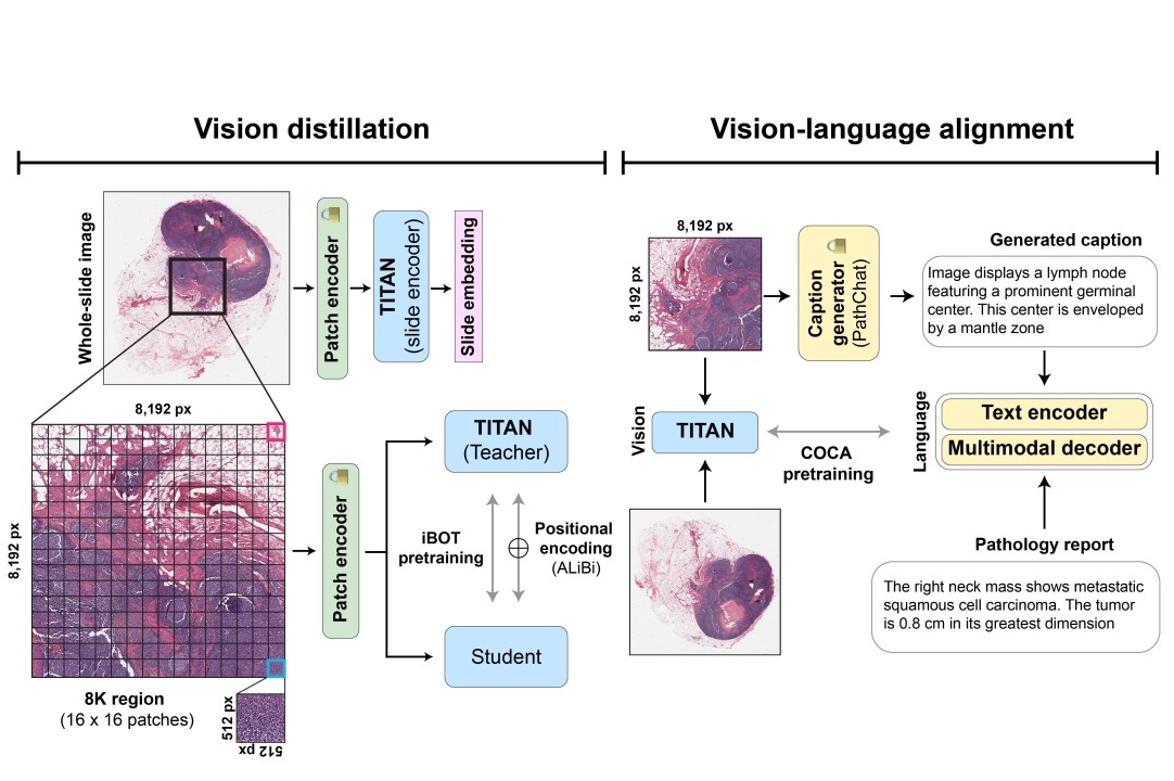 Building a Vision and Language-guided Multimodal Whole Slide Foundation ... Building a Vision and Language-guided Multimodal Whole Slide Foundation ...
