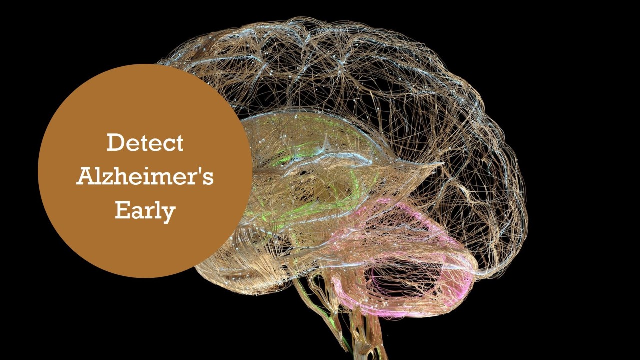 Harnessing Machine Learning for Alzheimer's Disease Detection Harnessing Machine Learning for Alzheimer's Disease Detection
