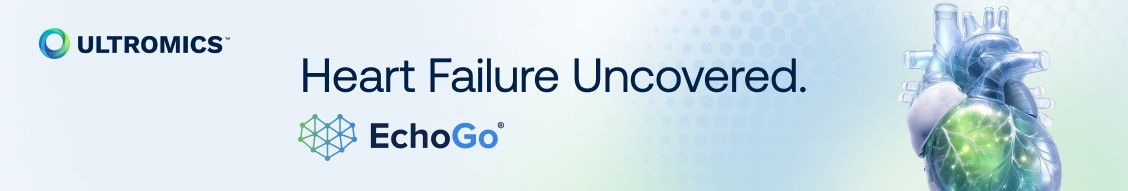 EchoGo® Heart Failure | LinkedIn EchoGo® Heart Failure | LinkedIn