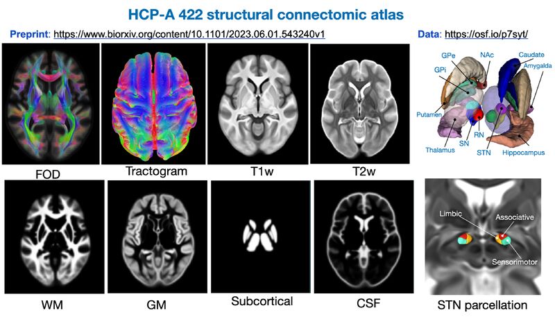 Yiming Xiao on LinkedIn: Brain atlases are essential tools in studying ... Yiming Xiao on LinkedIn: Brain atlases are essential tools in studying ...