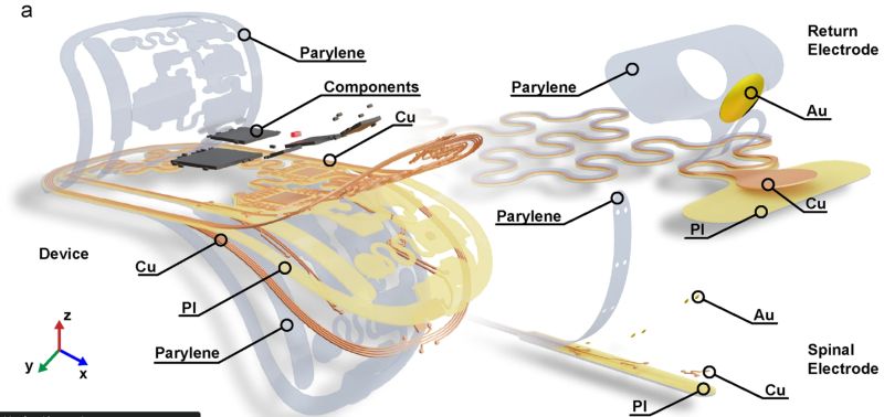 Bioelectronics Drop on LinkedIn: #stimulation Bioelectronics Drop on LinkedIn: #stimulation