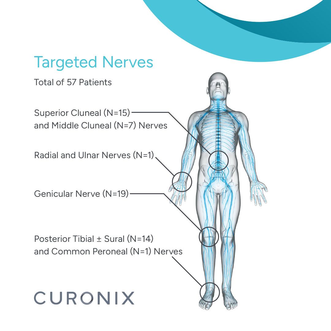 Curonix on LinkedIn: This independent retrospective study by Robert ... Curonix on LinkedIn: This independent retrospective study by Robert ...