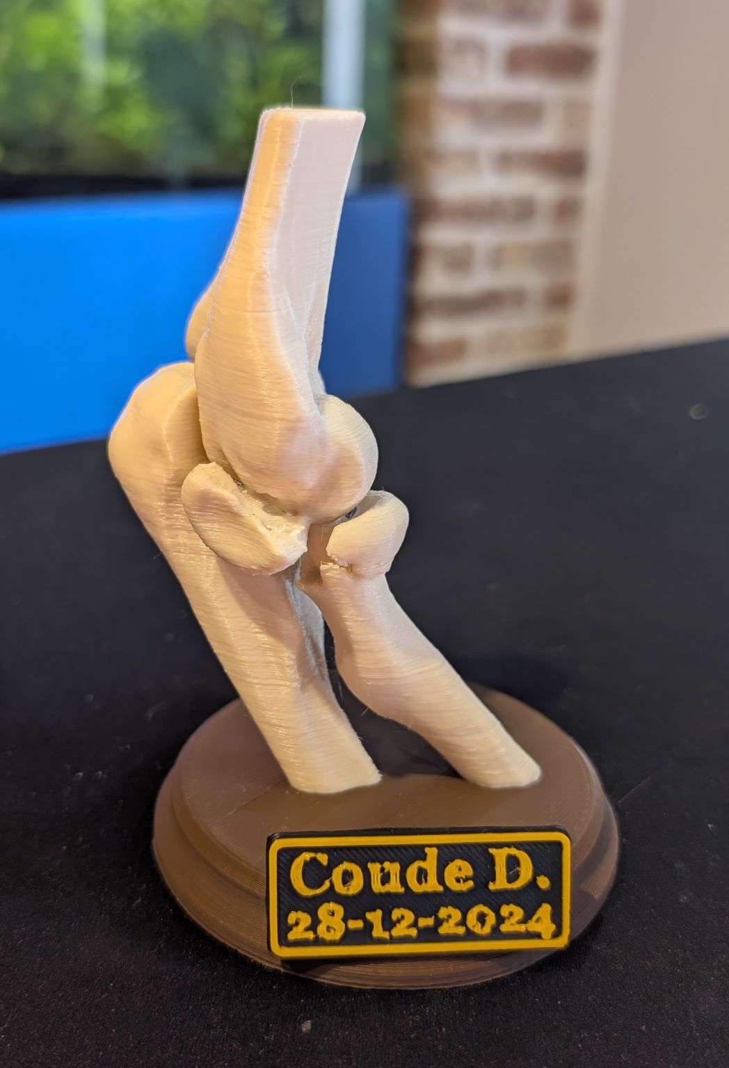 ️ Print your own bones! At the end of 2024, I fractured my elbow. It ... ️ Print your own bones! At the end of 2024, I fractured my elbow. It ...