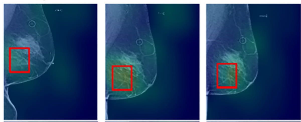 Diagnostic Imaging® on LinkedIn: #Mammography Study: #DeepLearning ... Diagnostic Imaging® on LinkedIn: #Mammography Study: #DeepLearning ...