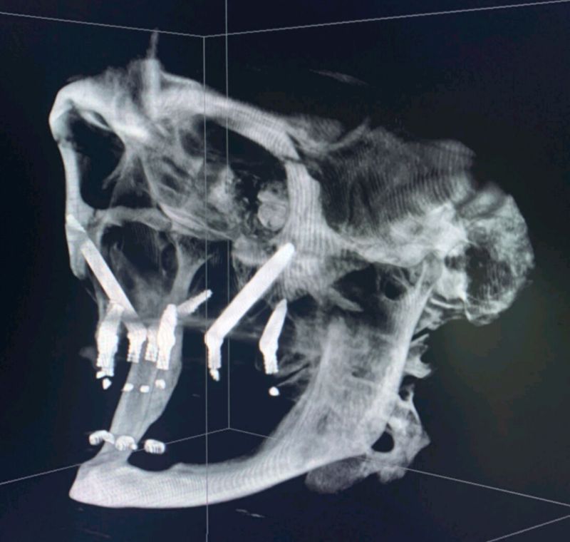 Rod Jacinto on LinkedIn: 🔴How would you treat that atrophic mandible? Rod Jacinto on LinkedIn: 🔴How would you treat that atrophic mandible?