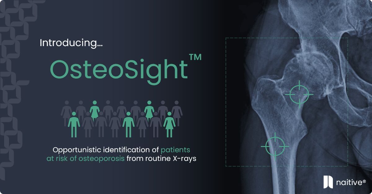 Naitive on LinkedIn: Introducing OsteoSight™, explainable AI to improve ... Naitive on LinkedIn: Introducing OsteoSight™, explainable AI to improve ...