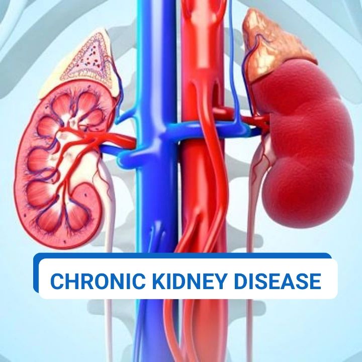 #health #awareness #education #nutrition #kidneys #diet #food #newpost ... #health #awareness #education #nutrition #kidneys #diet #food #newpost ...