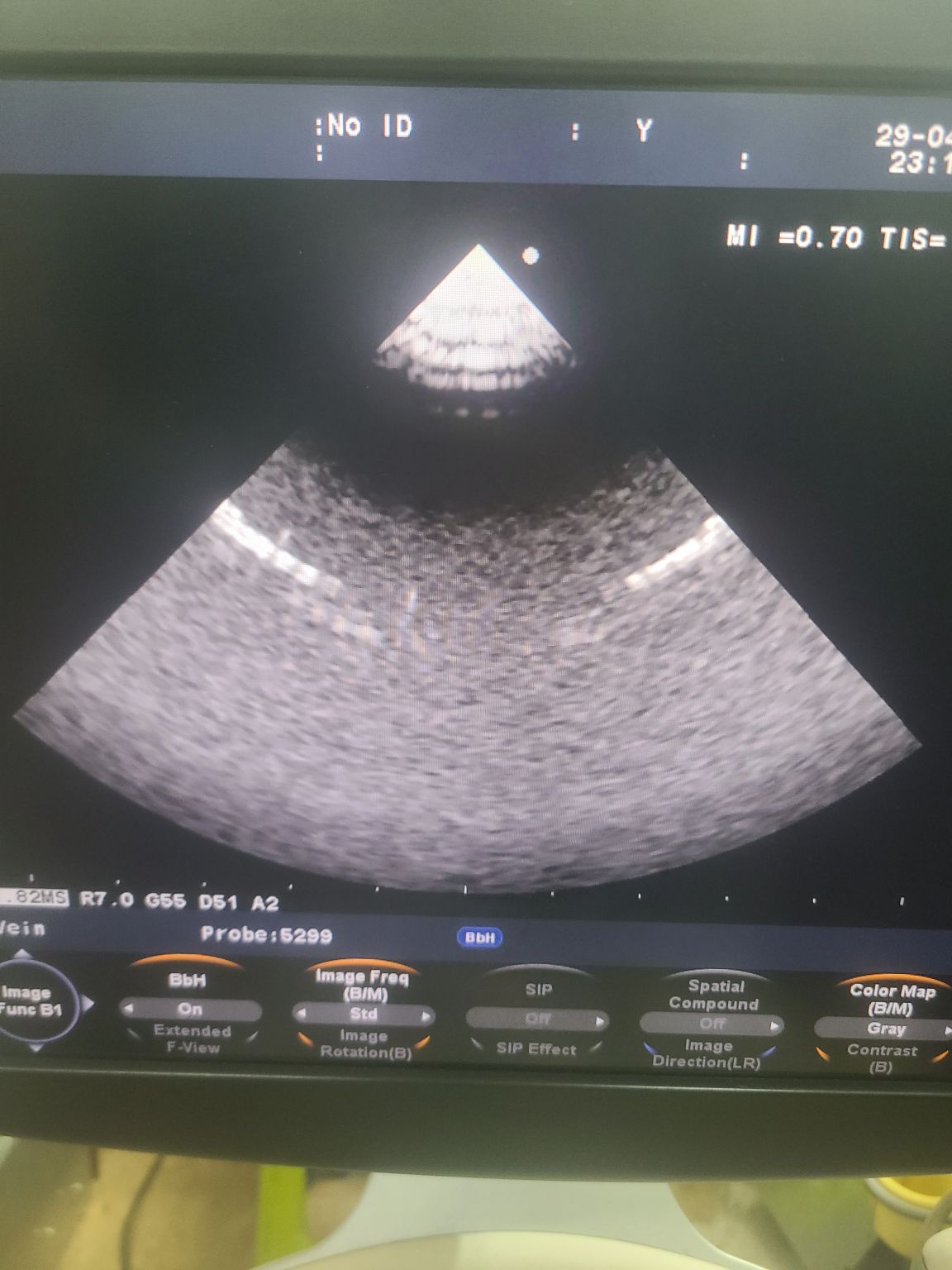 Engr Momin Hussain on LinkedIn: Hitachi F-37 Ultrasound Image Fault ... Engr Momin Hussain on LinkedIn: Hitachi F-37 Ultrasound Image Fault ...