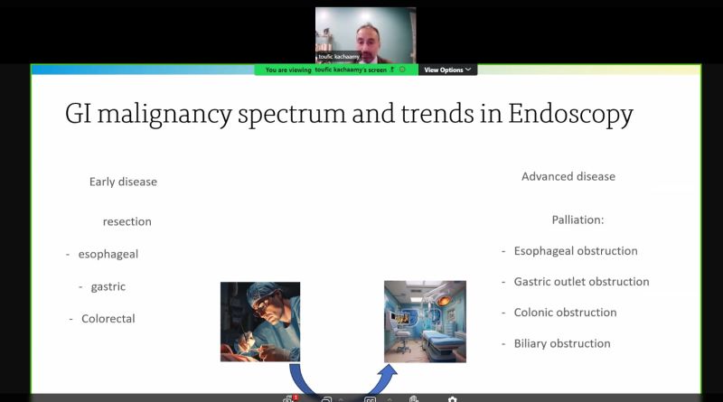OncoDaily on LinkedIn: #rectalcancer #globalcancermovement #oncodaily # ... OncoDaily on LinkedIn: #rectalcancer #globalcancermovement #oncodaily # ...