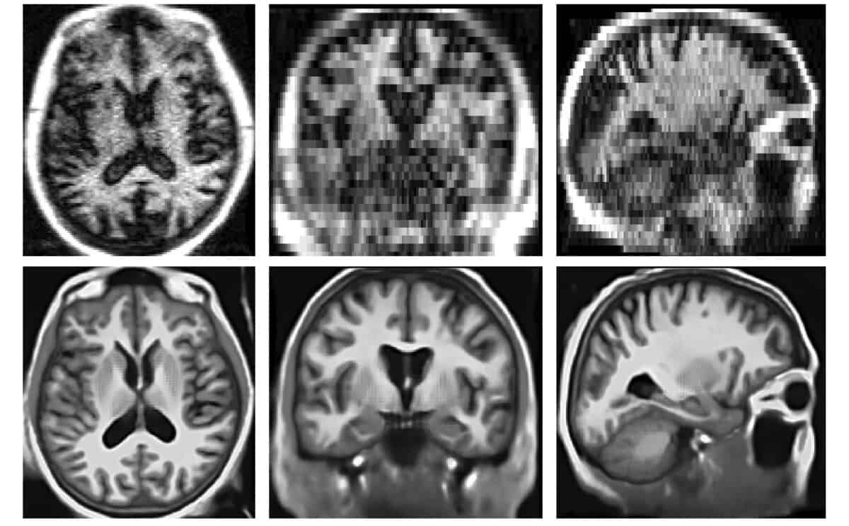Eric Feuilleaubois (Ph.D) on LinkedIn: AI creates high-resolution brain ... Eric Feuilleaubois (Ph.D) on LinkedIn: AI creates high-resolution brain ...