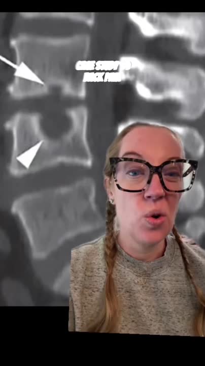 Case study 99: Adult with back pain | Betsy Grunch, MD posted on the ... Case study 99: Adult with back pain | Betsy Grunch, MD posted on the ...