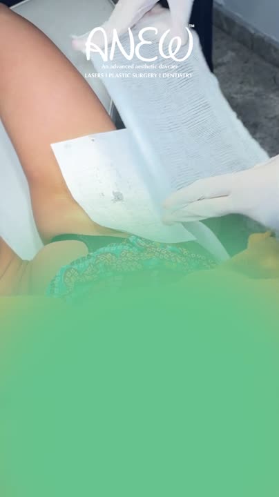 #anew #anewcosmeticclinic #miradry #miradryfresh #miradrytreatment ... #anew #anewcosmeticclinic #miradry #miradryfresh #miradrytreatment ...
