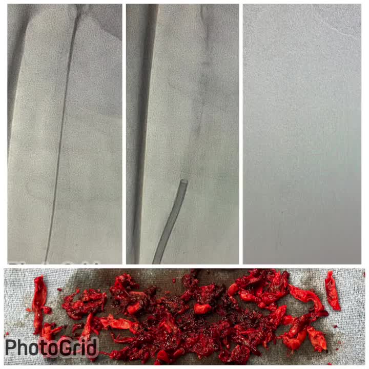 Ruben Garcia (CVT) posted on LinkedIn Ruben Garcia (CVT) posted on LinkedIn