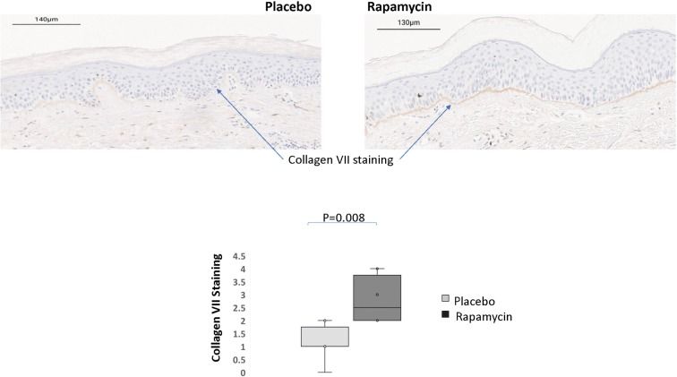 Robert Lufkin MD on LinkedIn: Topical rapamycin in humans resulted in ... Robert Lufkin MD on LinkedIn: Topical rapamycin in humans resulted in ...