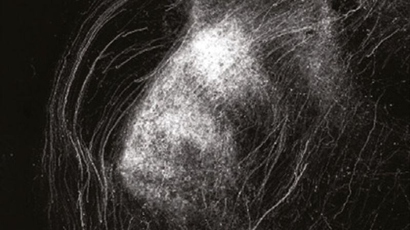 Medical Xpress on LinkedIn: Mixed signals: Mouse moms study explores ... Medical Xpress on LinkedIn: Mixed signals: Mouse moms study explores ...