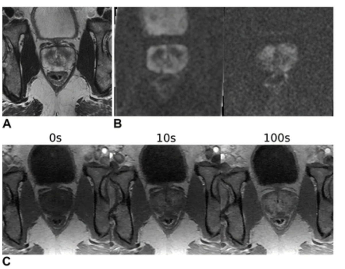 GCG Global Healthcare on LinkedIn: MRI Study Suggests Deep Learning ... GCG Global Healthcare on LinkedIn: MRI Study Suggests Deep Learning ...