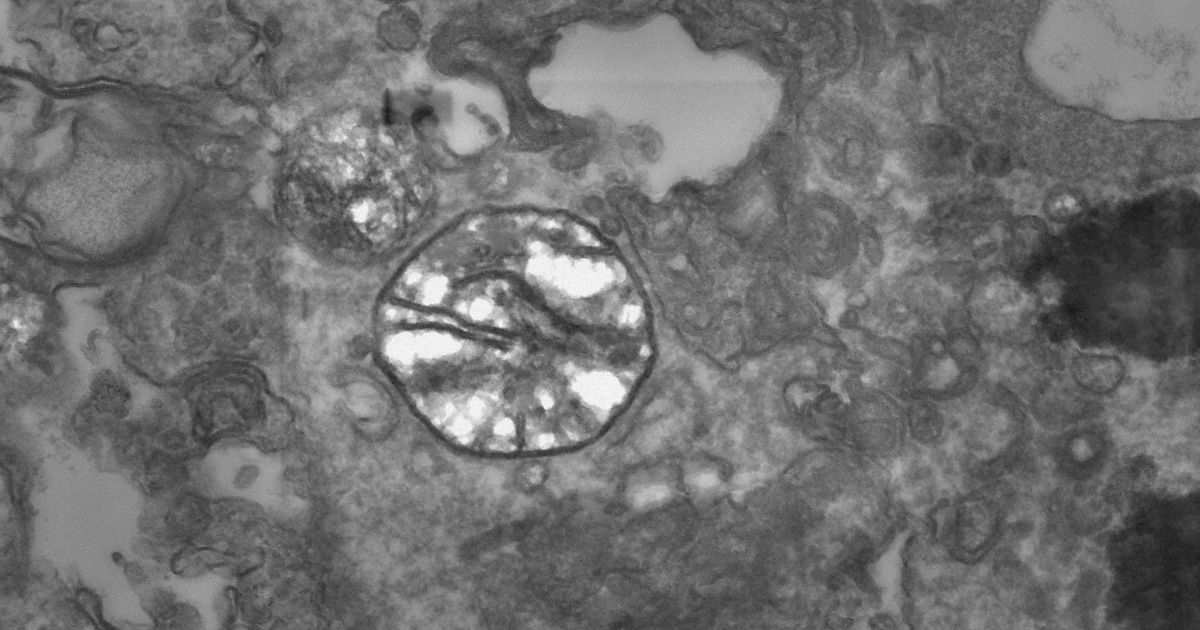 My Modern Met on LinkedIn: Scientists Discover First-Ever Organism That ... My Modern Met on LinkedIn: Scientists Discover First-Ever Organism That ...