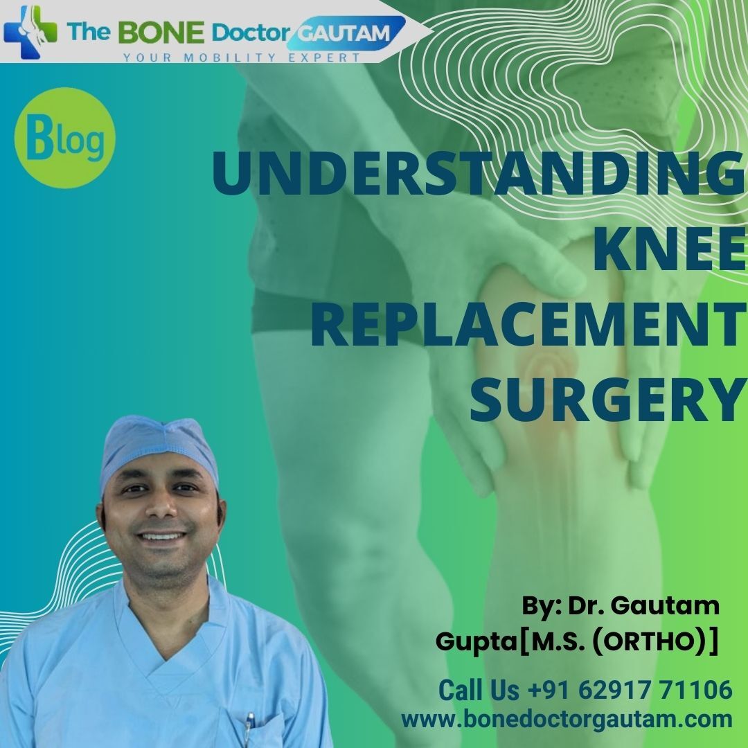 Dr. Gautam Gupta on LinkedIn: Dr Gautam Gupta on Instagram: Dr. Gautam Gupta on LinkedIn: Dr Gautam Gupta on Instagram: