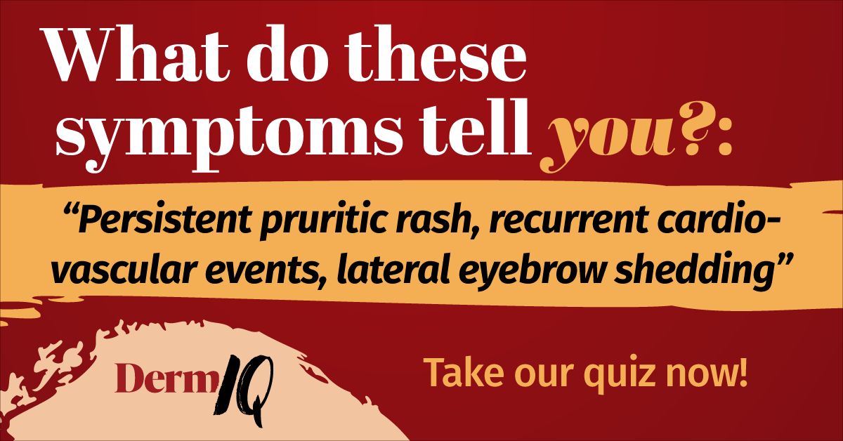 Dermatology Times on LinkedIn: Put your atopic dermatitis knowledge to ... Dermatology Times on LinkedIn: Put your atopic dermatitis knowledge to ...