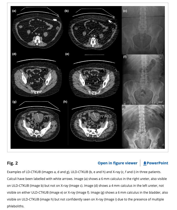 Journal of Medical Imaging and Radiation Oncology on LinkedIn: Further ... Journal of Medical Imaging and Radiation Oncology on LinkedIn: Further ...