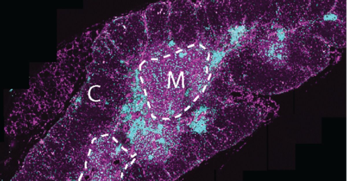 Fred Hutch on LinkedIn: ‘Black hole’ formed by aging cells hobbles key ... Fred Hutch on LinkedIn: ‘Black hole’ formed by aging cells hobbles key ...