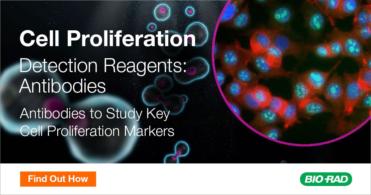 Bio-Rad Antibodies on LinkedIn: Cell Proliferation & Viability ... Bio-Rad Antibodies on LinkedIn: Cell Proliferation & Viability ...
