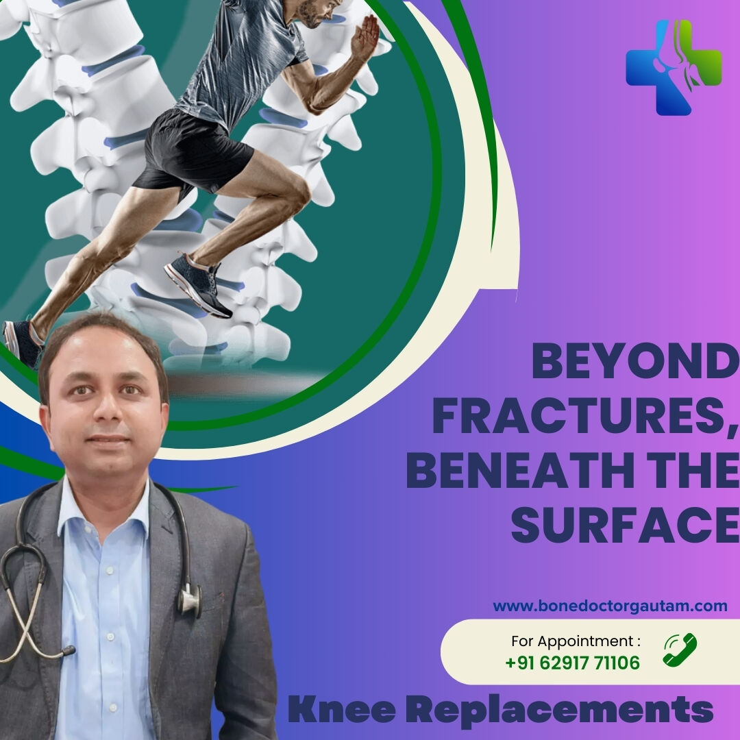 Dr. Gautam Gupta on LinkedIn: Dr Gautam Gupta on Instagram: Dr. Gautam Gupta on LinkedIn: Dr Gautam Gupta on Instagram: