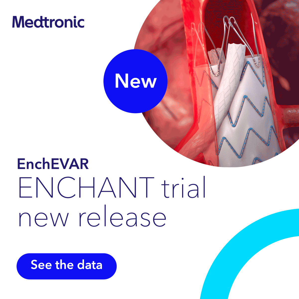 Medtronic Cardiac and Vascular on LinkedIn: EnChEVAR - Aortic ... Medtronic Cardiac and Vascular on LinkedIn: EnChEVAR - Aortic ...