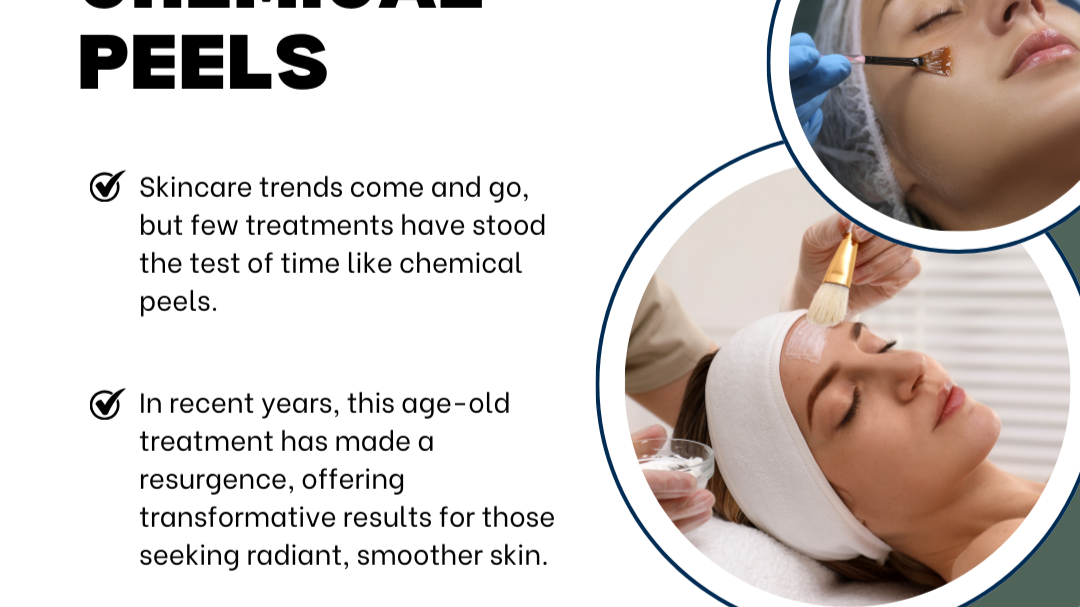 Get Glowing: How Chemical Peels Are Revolutionizing Skincare in Dallas, TX Get Glowing: How Chemical Peels Are Revolutionizing Skincare in Dallas, TX