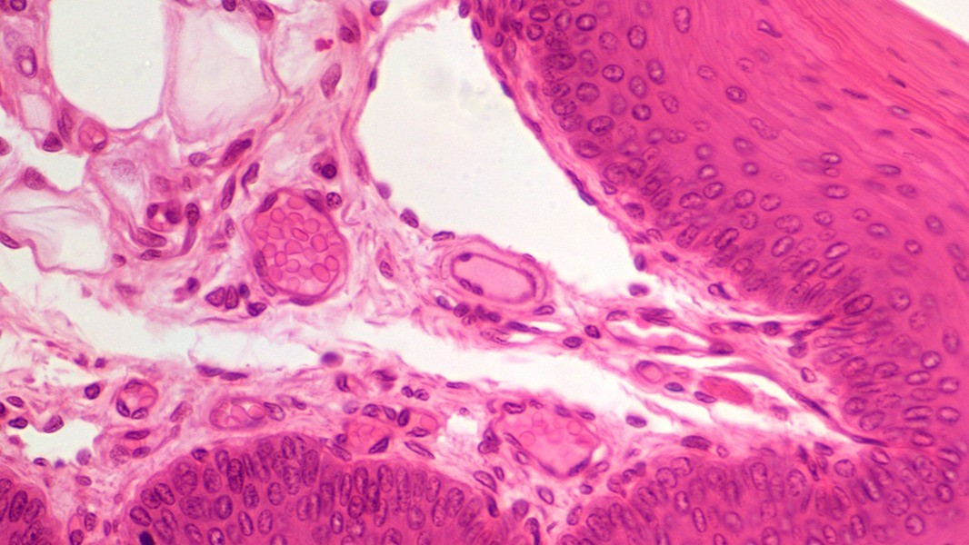 HE staining: the HE staining: the
