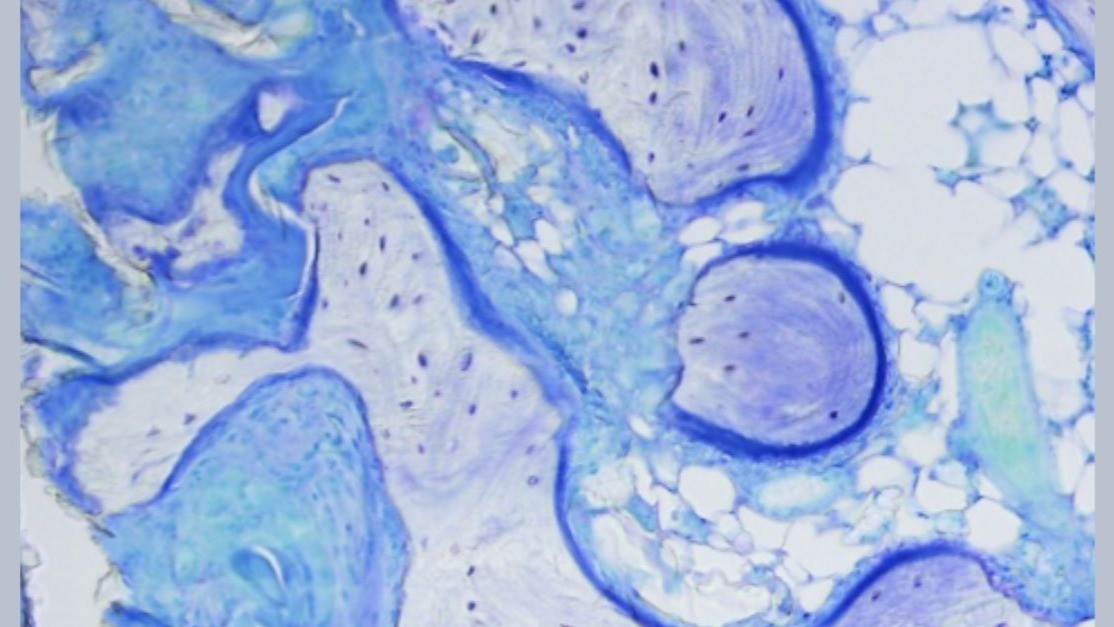 Proteoglycan Errors in Embryonic Bone Development: A Closer Look Proteoglycan Errors in Embryonic Bone Development: A Closer Look