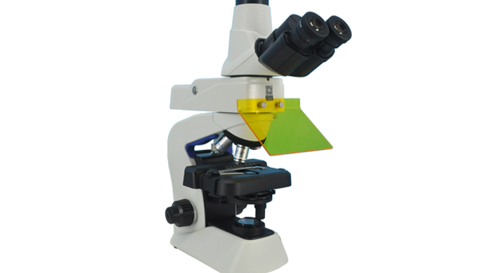 Application of fluorescence microscopy in detection of antinuclear ... Application of fluorescence microscopy in detection of antinuclear ...