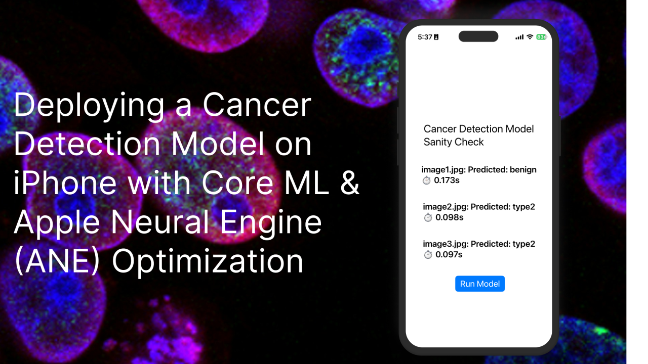 Deploying a Cancer Detection Model on the iPhone with Core ML & Apple ... Deploying a Cancer Detection Model on the iPhone with Core ML & Apple ...