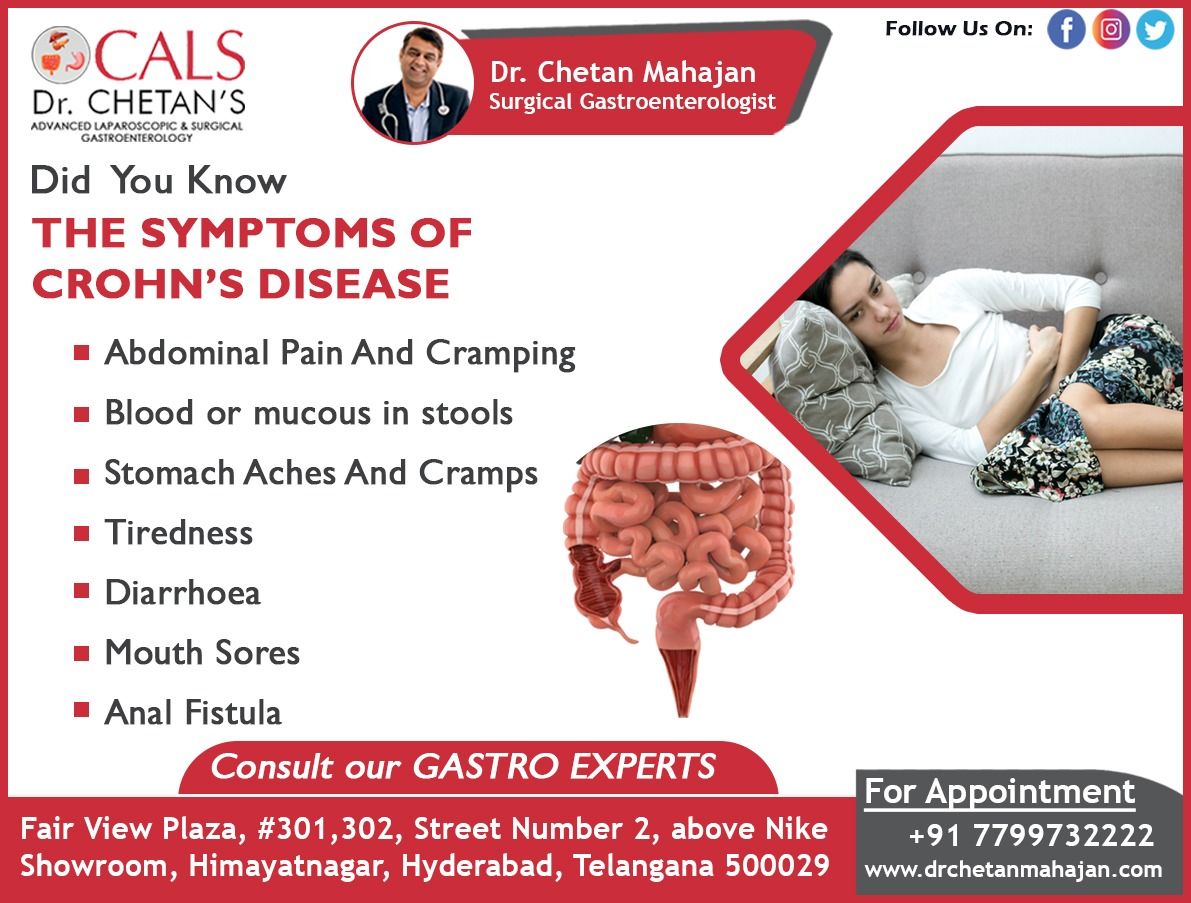 Dr. Chetan Mahajan en LinkedIn: #crohn #abdominalpain #weightloss # ... Dr. Chetan Mahajan en LinkedIn: #crohn #abdominalpain #weightloss # ...