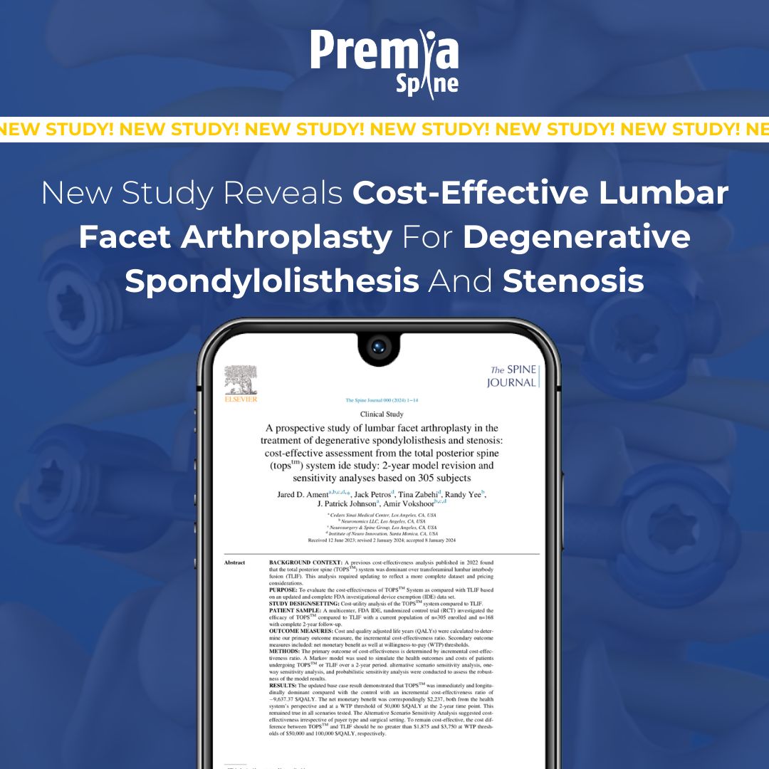 Premia Spine on LinkedIn: #premiaspine #topssystem #spinehealth # ... Premia Spine on LinkedIn: #premiaspine #topssystem #spinehealth # ...