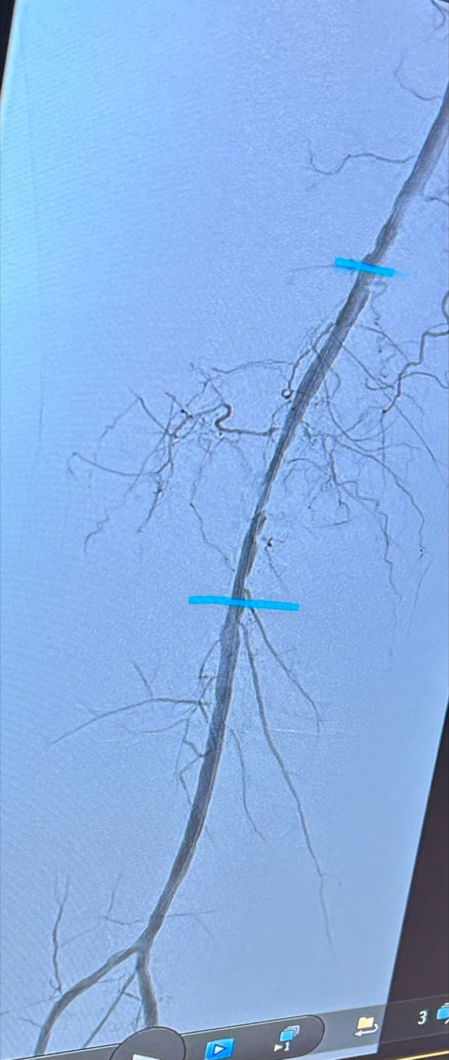 CAT6 1 pass 40 EBL 🚫 Cold Leg | Ruben Garcia (CVT) CAT6 1 pass 40 EBL 🚫 Cold Leg | Ruben Garcia (CVT)