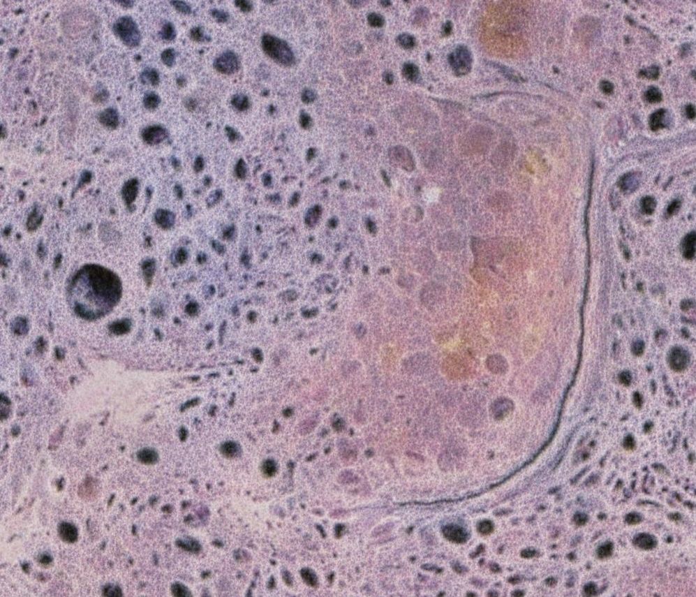 Aadi K. on LinkedIn: #pathology #ai #digitalpathology #ki67 # ... Aadi K. on LinkedIn: #pathology #ai #digitalpathology #ki67 # ...