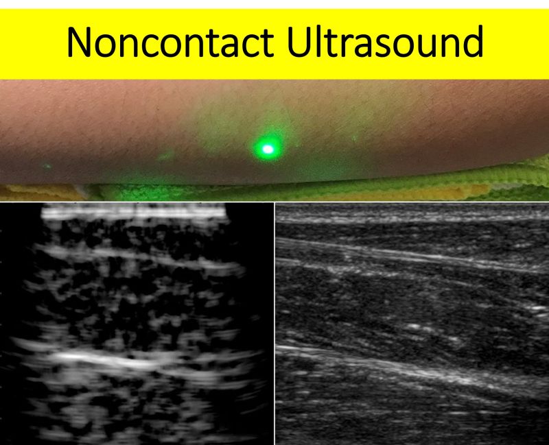 #healthtech #innovation #ultrasound #materials | Vineeth Venugopal | 32 ... #healthtech #innovation #ultrasound #materials | Vineeth Venugopal | 32 ...