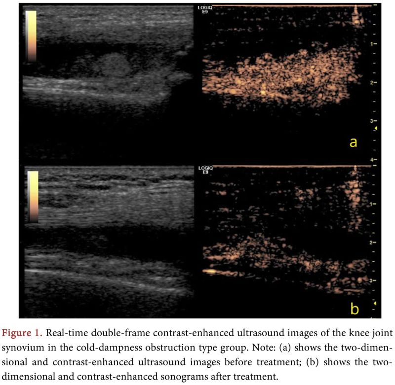 Scientific Research Publishing, Inc. USA on LinkedIn: #knee ... Scientific Research Publishing, Inc. USA on LinkedIn: #knee ...