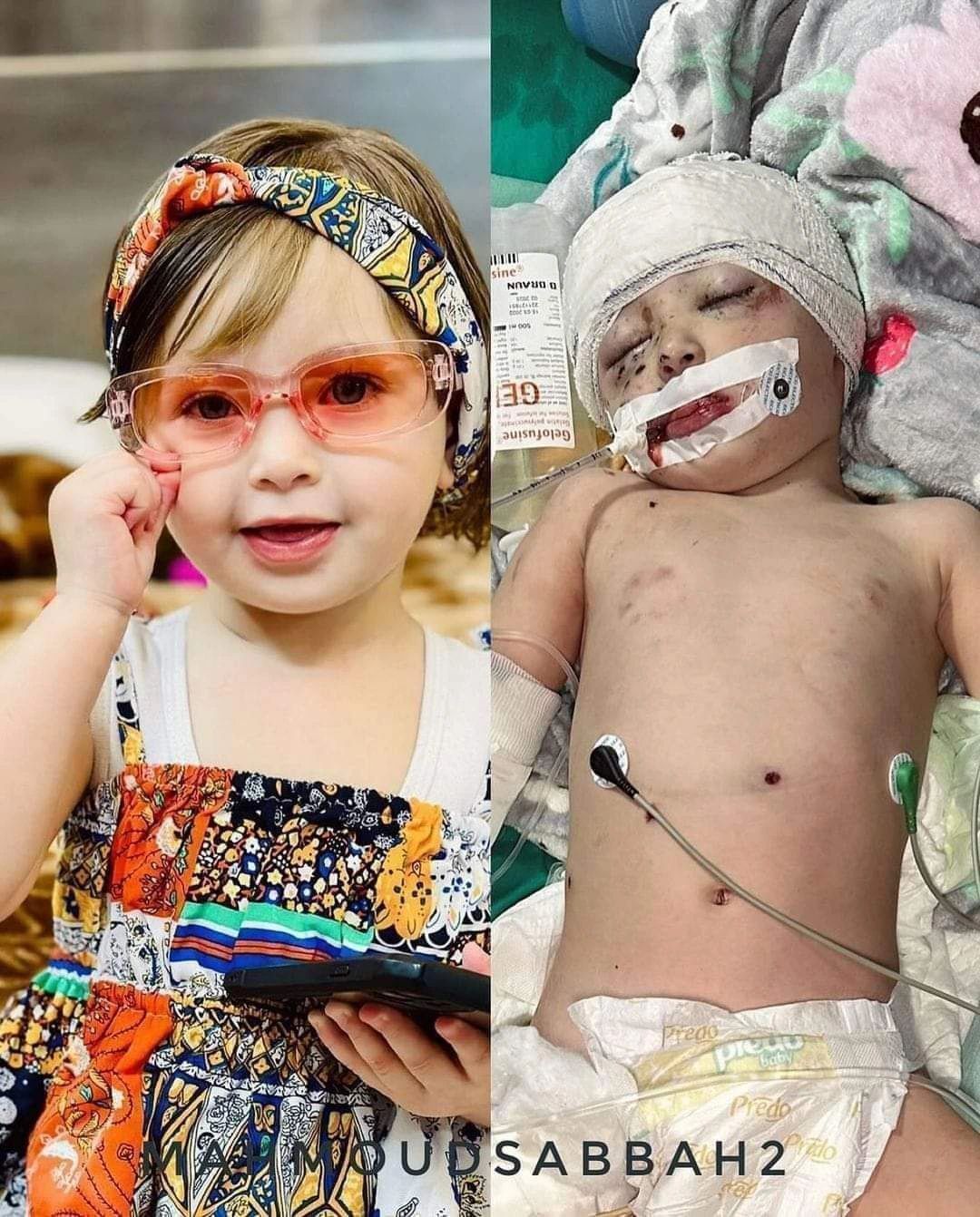 zeinab bakr on LinkedIn: Gaza children before and after zeinab bakr on LinkedIn: Gaza children before and after