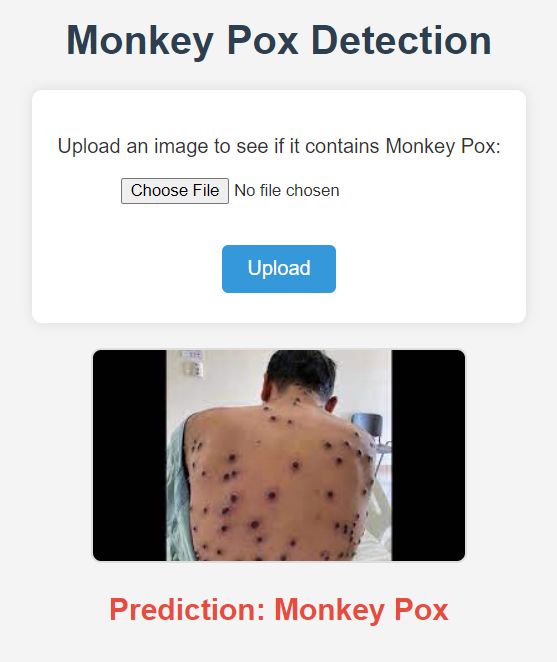 Mirza Mohibul Hasan on LinkedIn: My latest project: Monkeypox Skin ... Mirza Mohibul Hasan on LinkedIn: My latest project: Monkeypox Skin ...