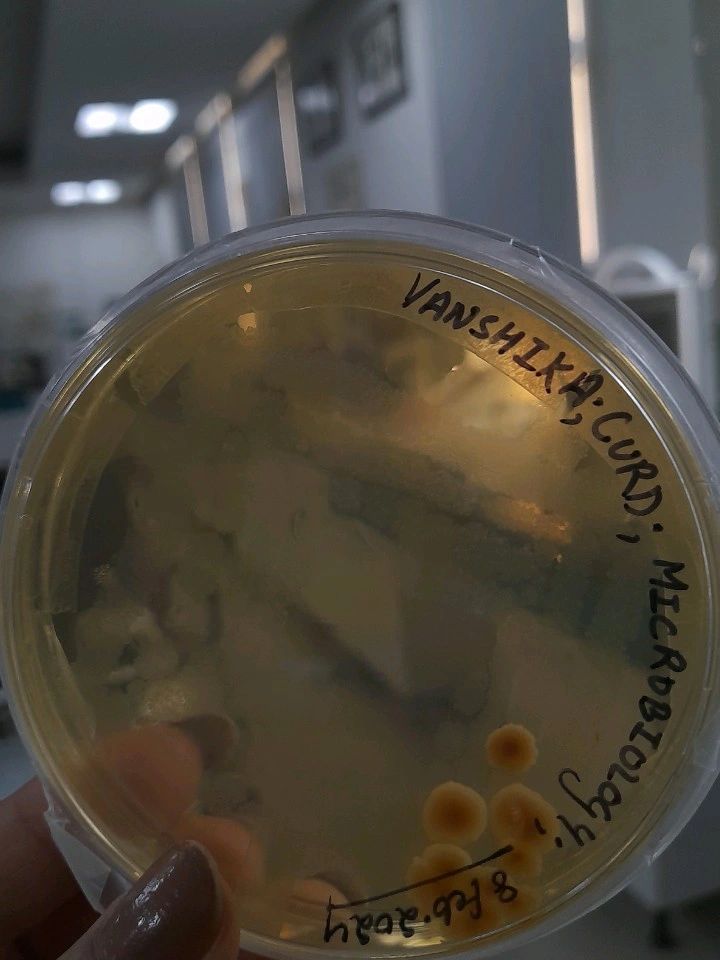 YEPL agar medium for yeast isolation | Vanshika Aggarwal posted on the ... YEPL agar medium for yeast isolation | Vanshika Aggarwal posted on the ...