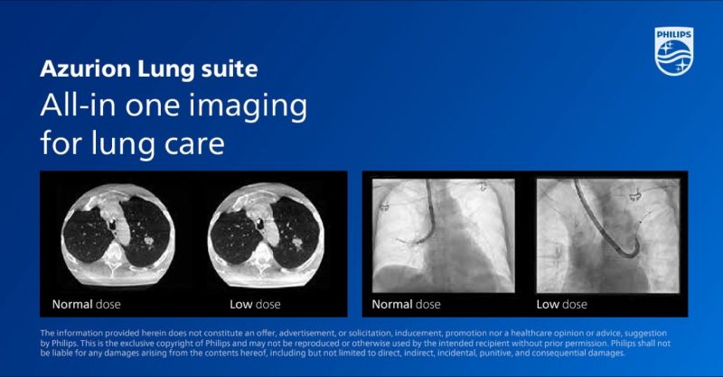 Tarun Aggarwal on LinkedIn: #azurion #cathlab #lungsuite #lungcare Tarun Aggarwal on LinkedIn: #azurion #cathlab #lungsuite #lungcare