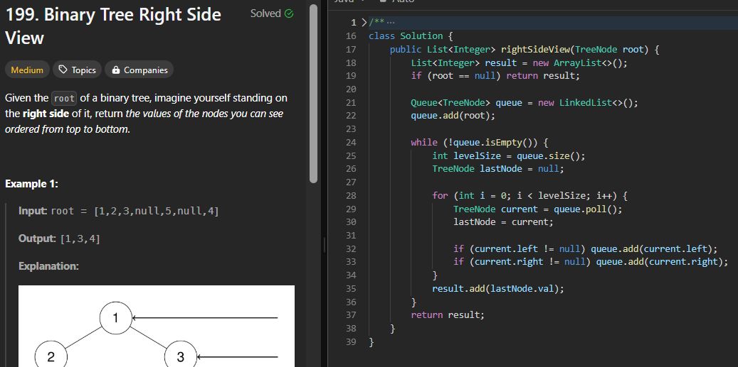 #150daysofcode #codingchallenge #dsa #binarytree #rightsideview… | Raj #150daysofcode #codingchallenge #dsa #binarytree #rightsideview… | Raj