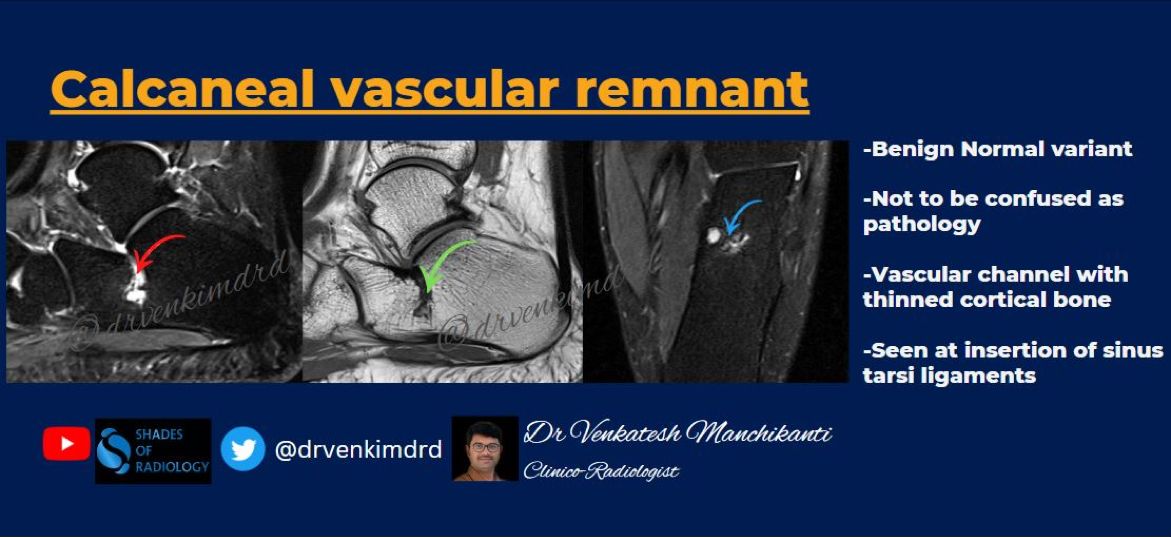 Dr Venkatesh M MD DNB EDiR MNAMS FAGE posted on LinkedIn Dr Venkatesh M MD DNB EDiR MNAMS FAGE posted on LinkedIn
